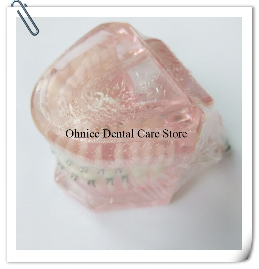 Dental orthodontic teeth model withbrackets buccal... – Grandado
