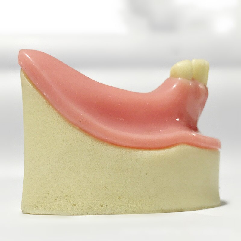 7 type Dental implant practice model Teaching and ... – Grandado