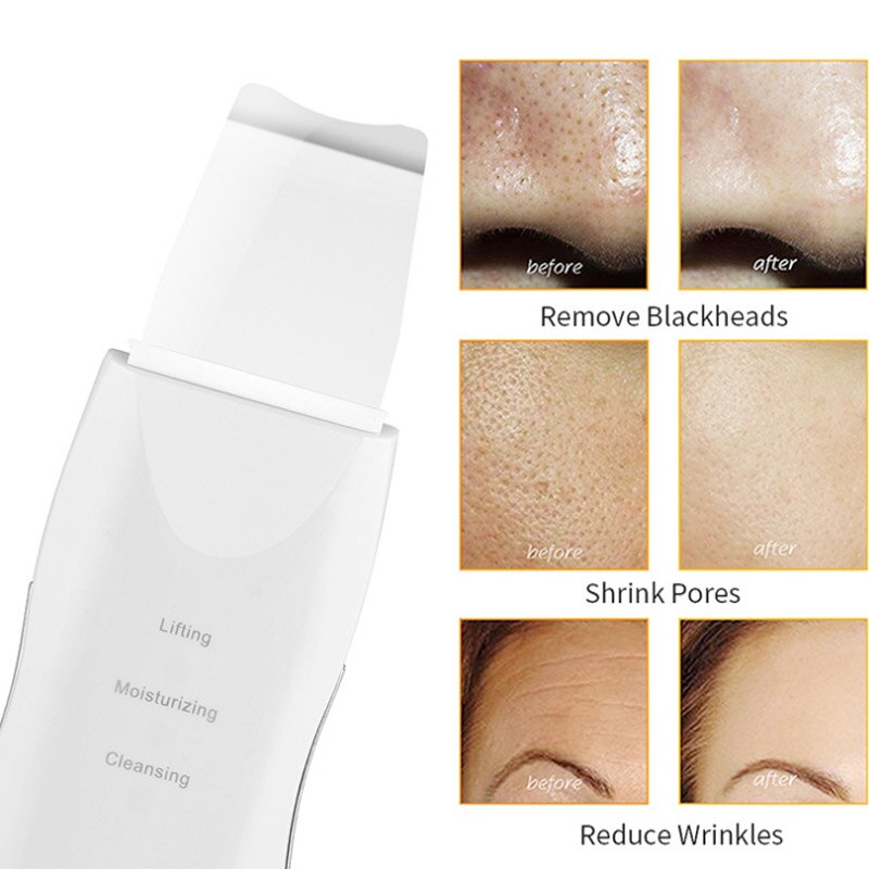 Ultrasonic Skin Scrubber Deep Face Cleaning Machin... – Grandado