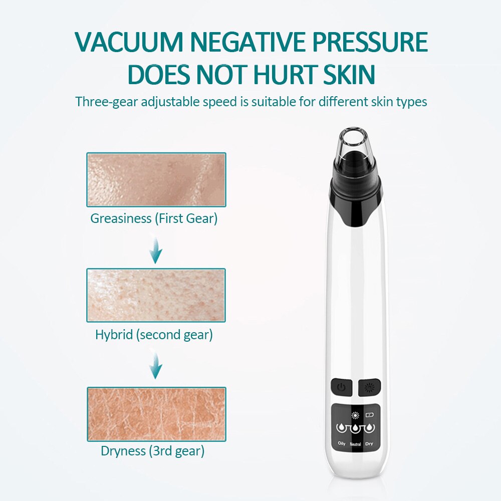 Pimples Squeeze Heating Blackhead Remover Vacuum E... – Grandado