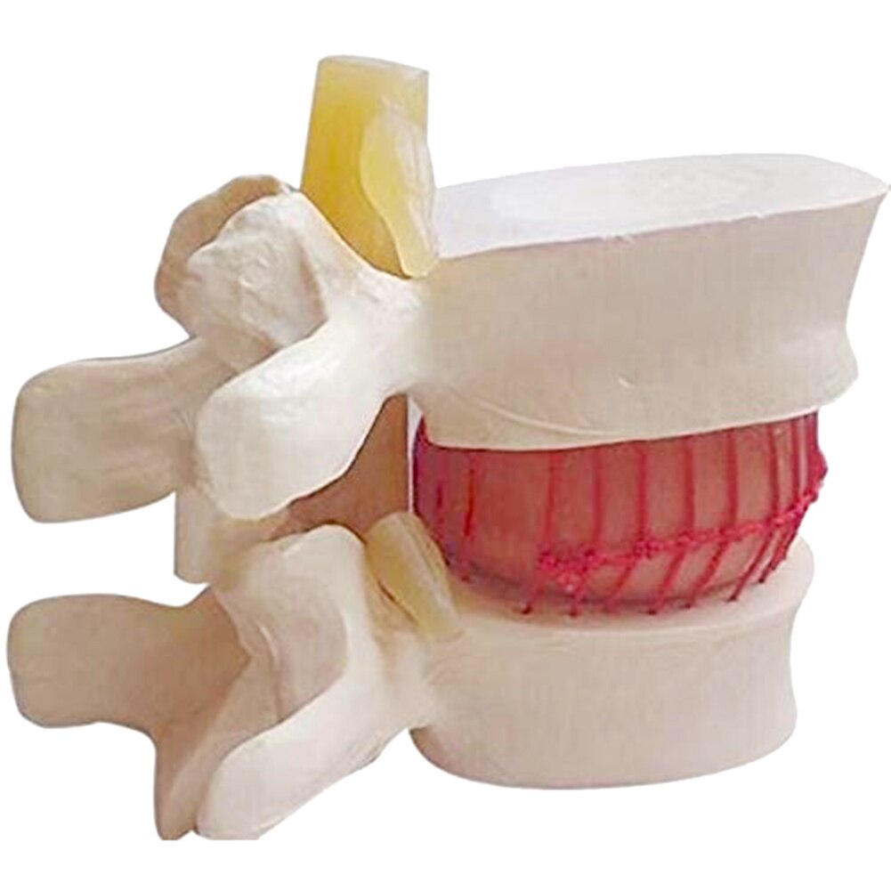 1pc 1.5x IV And V Lumbar And Spinal Nerves Anatomi... – Grandado