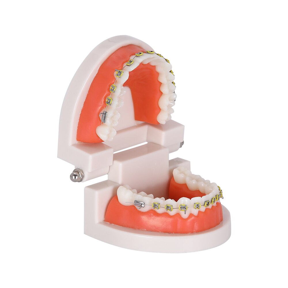 Dental Orthodontic Teeth Model Tooth Model with Me... – Vicedeal
