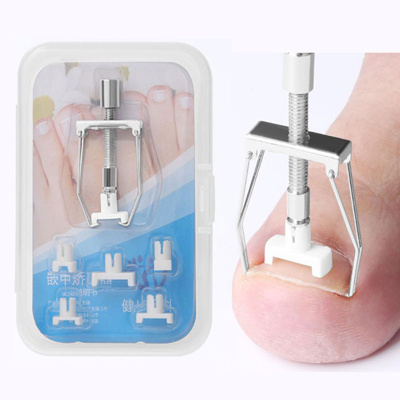 Ingrown Toe Nail Fixer Pedicure Recover Embed Toen... – Grandado