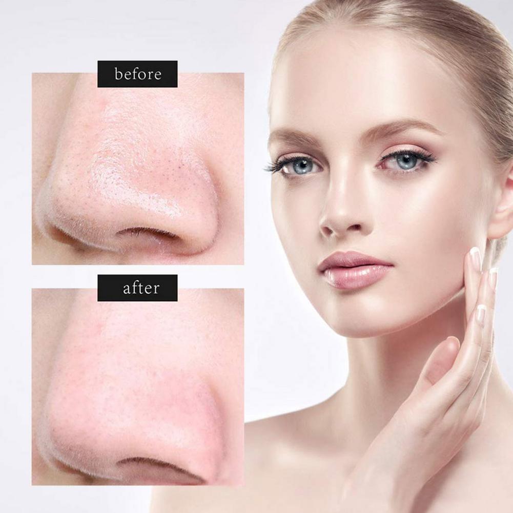 Face Cleaner Ultrasonic Skin Scrubber USB Recharge... – Vicedeal