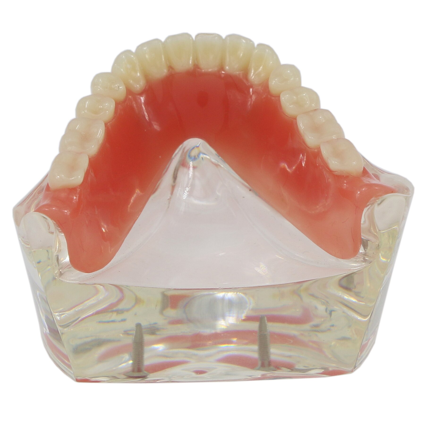 Dental Implant Teeth Model M6002 Typodont Overdent... – Vicedeal