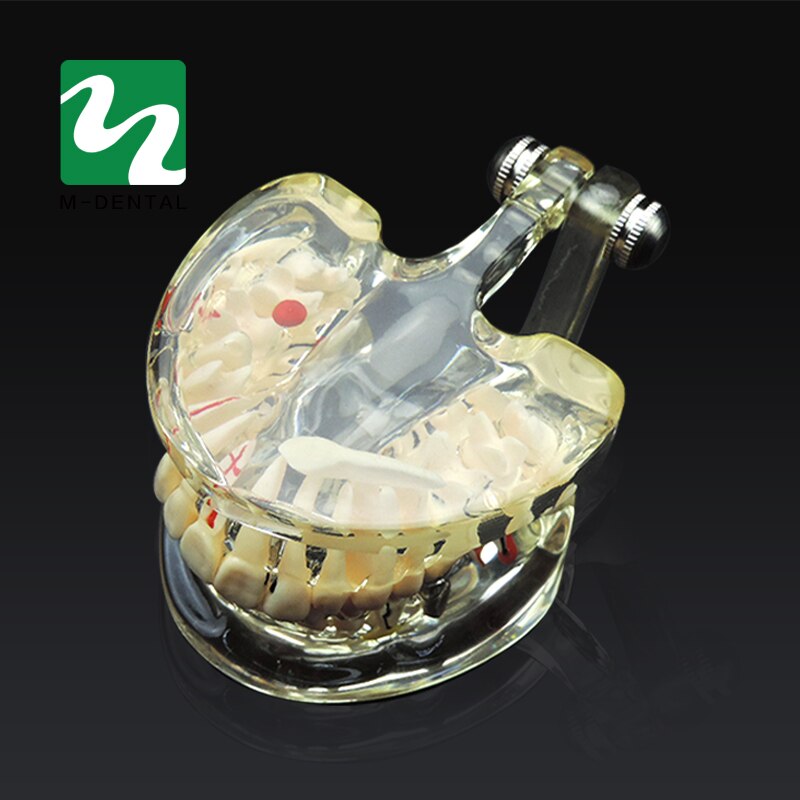 Dental Study Tooth Model Adult Pathological& D... – Vicedeal