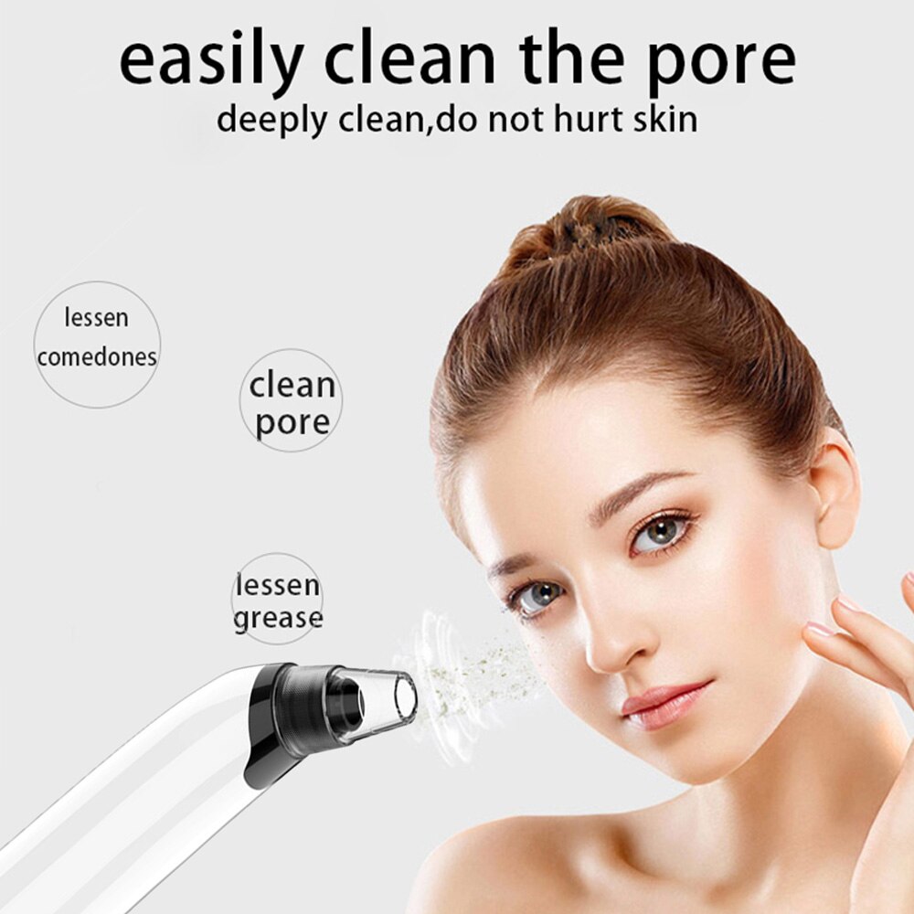 Pimples Squeeze Heating Blackhead Remover Vacuum E... – Grandado