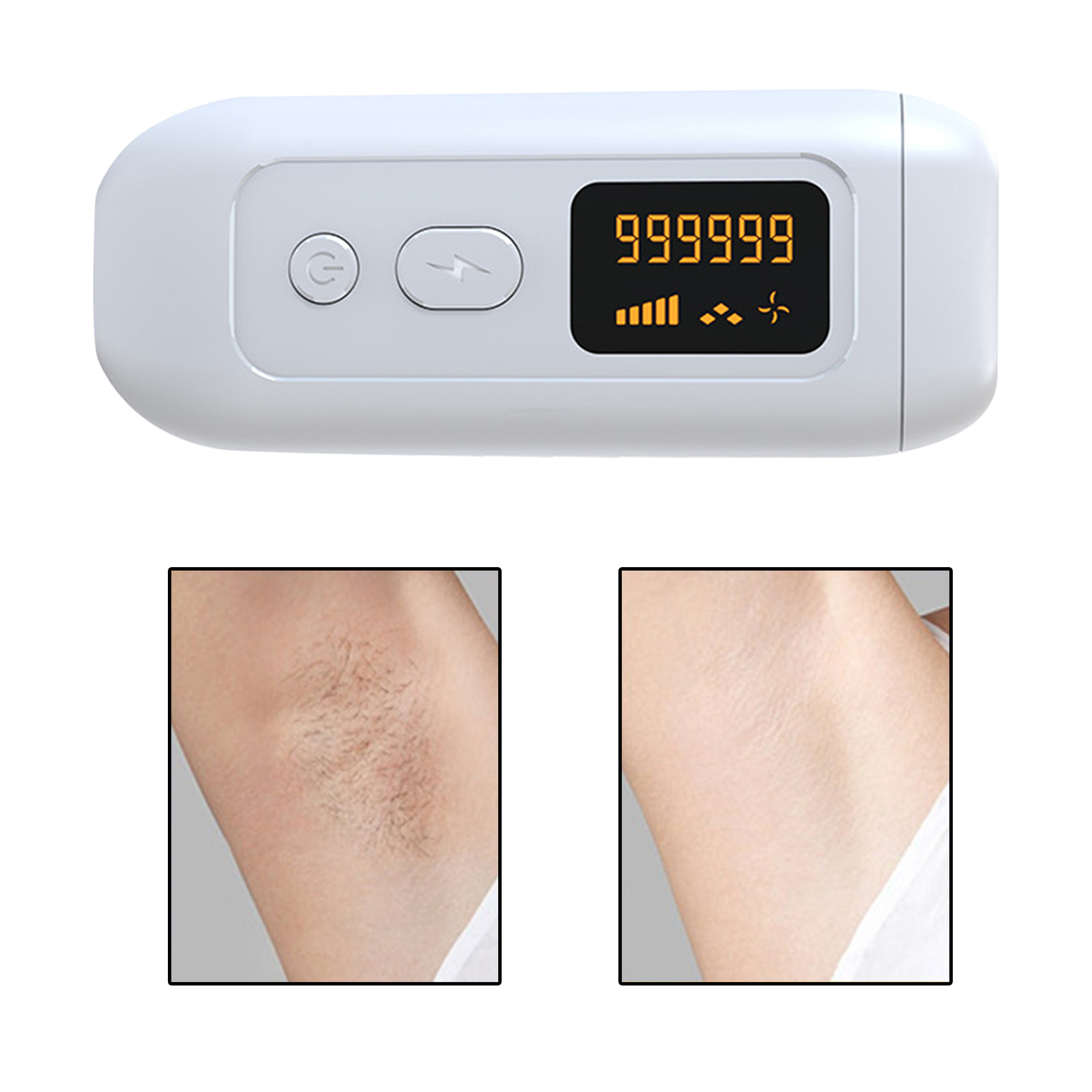 990000 Flashes Hair Removal Instrument Permanent E... – Vicedeal