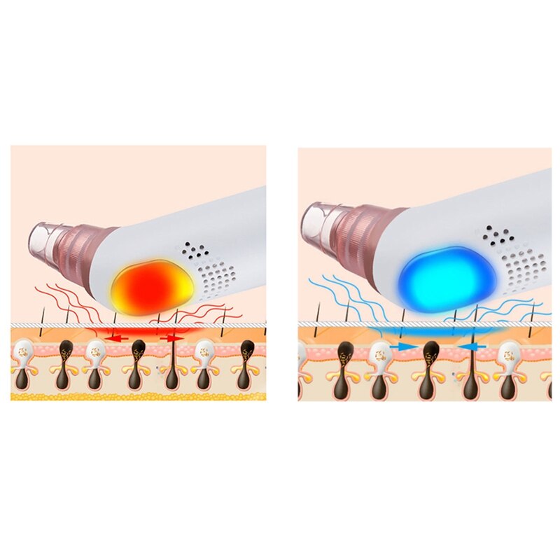 Blackhead Remover Skin Care Face Deep Pore Acne Pi... – Vicedeal