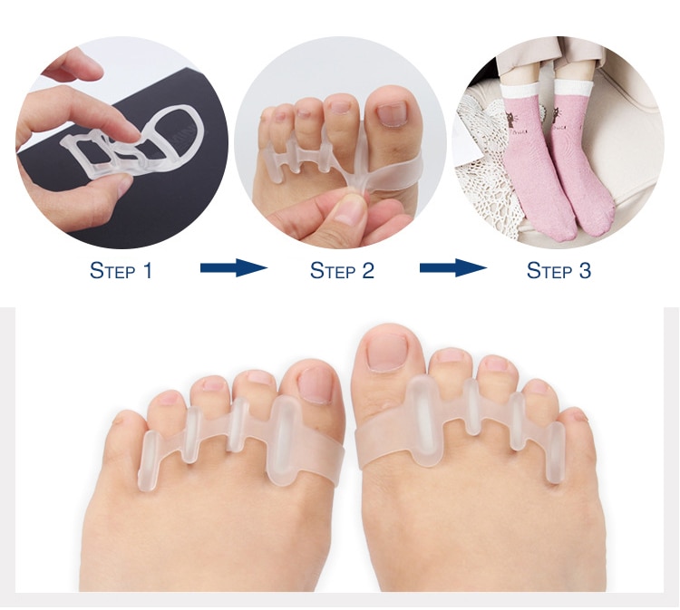 1 Pair Silicone Toe Separator Toes Overlapping Sep... – Vicedeal