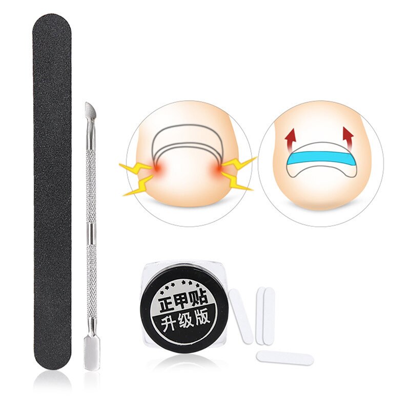 Roestvrij Ingegroeide Voetverzorging Tool Teen Nag... – Grandado