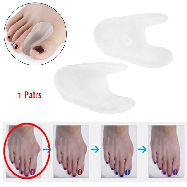 2pcs Silicone toe isolation pad, thumb valgus orth... – Grandado