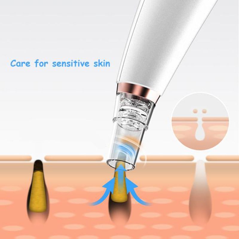 Electric Blackhead Remover Point Noir Blackhead Va... – Vicedeal