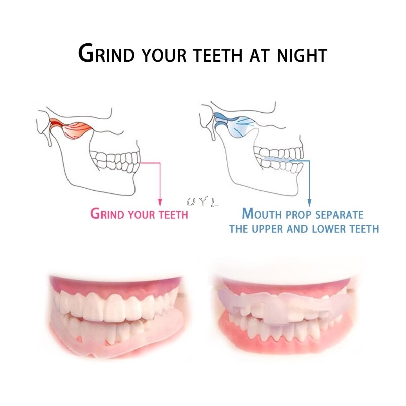 Protector Dental Anti-molienda, Protector bucal, b... – Grandado