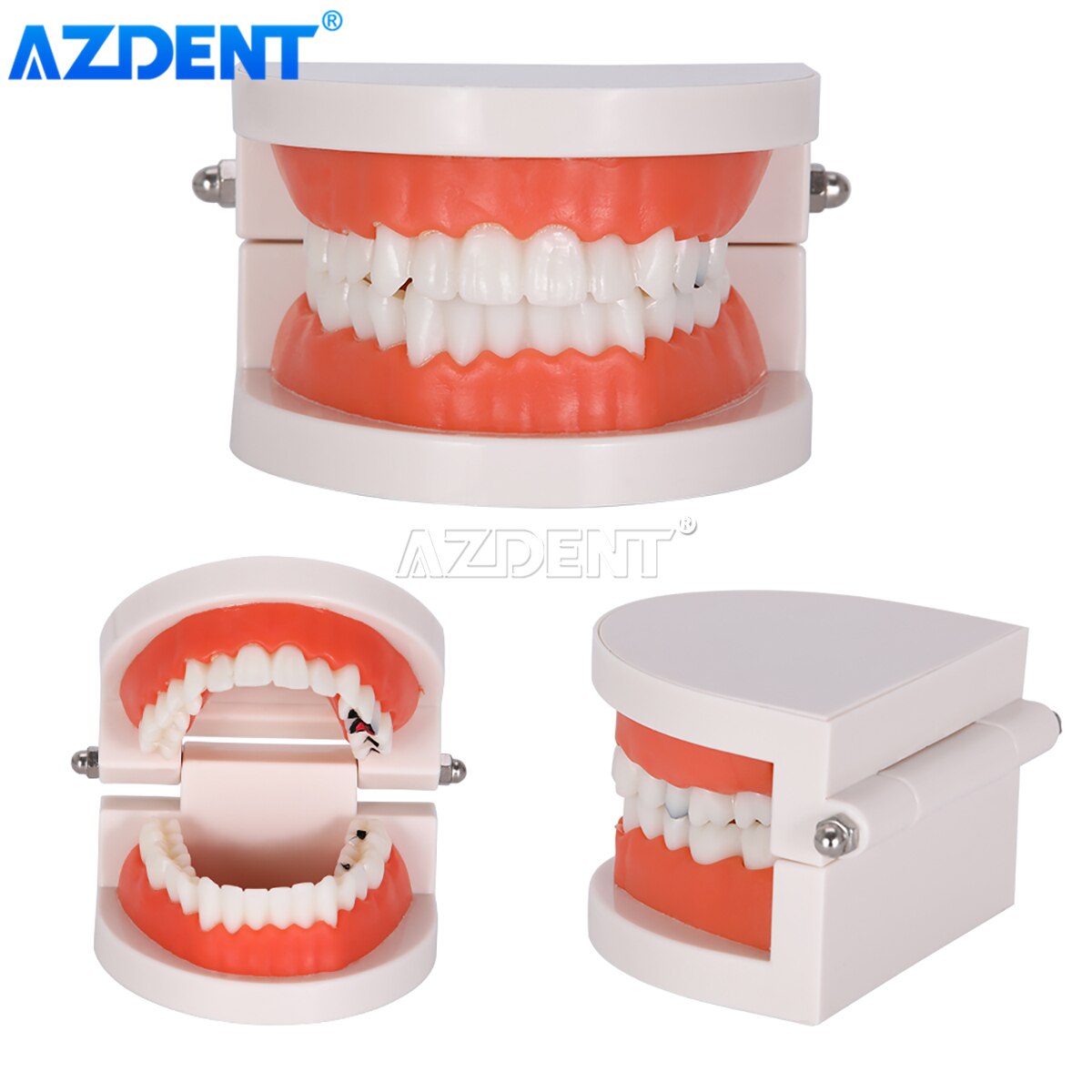 Dental Tooth Decay Teeth Model Dental Orthodontic ... – Vicedeal