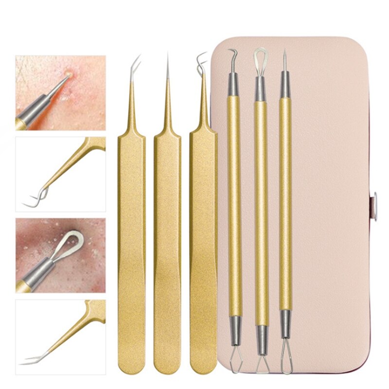 Stainless Steel Acne Extractor Remover Blackhead B... – Vicedeal