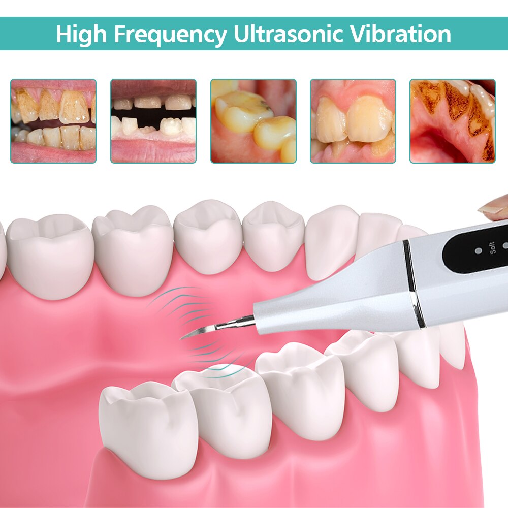 Ultrasonic Dental Calculus Remover Household Tarta... – Vicedeal
