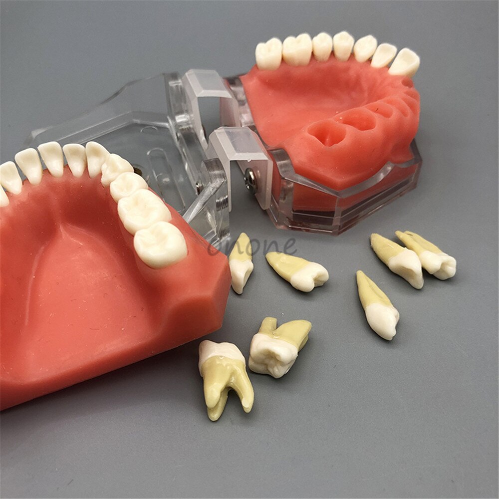 Dental Standard Model with Removable Teeth Dental ... – Vicedeal
