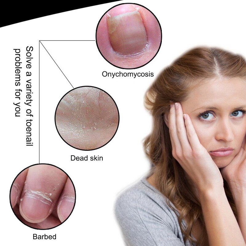 Professionele Voeten Teen Nagelknipper Trimmer Cut... – Vicedeal