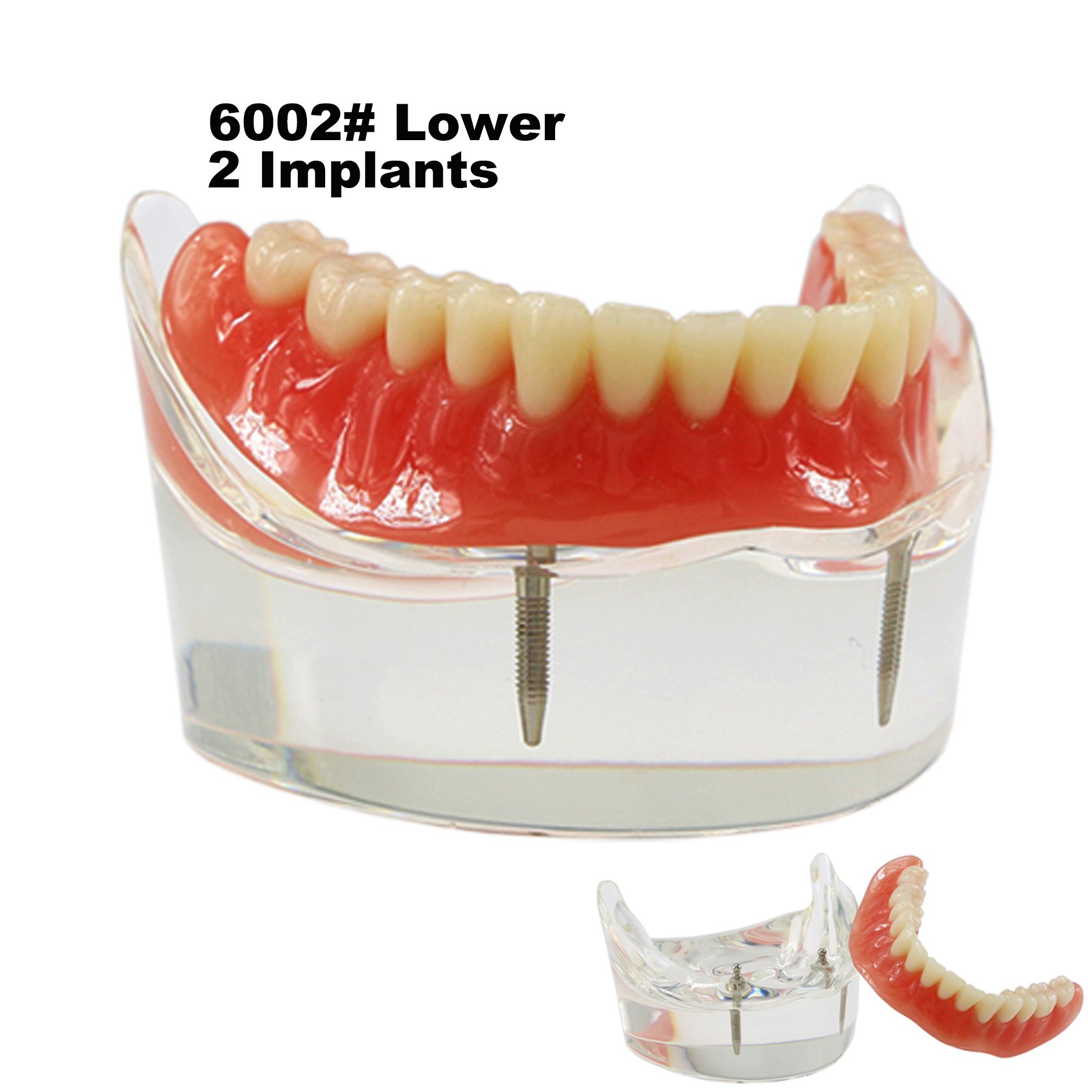 Dental Implant Teeth Model M6002 Typodont Overdent... – Vicedeal