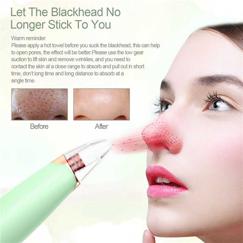 CkeyiN 3 In 1 Blackhead Remover Vacuum Suction Fac... – Grandado