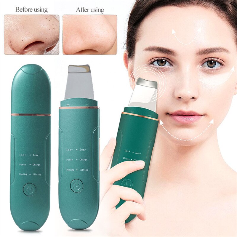 Ultrasonic Skin Scrubber Deep Face Cleaning Machin... – Vicedeal