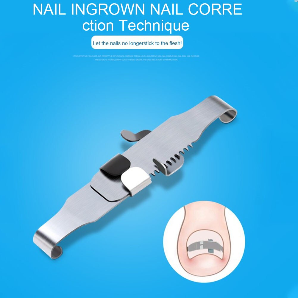 Lifter PE Tape Stainless Steel Ingrown Toenail Too... – Grandado