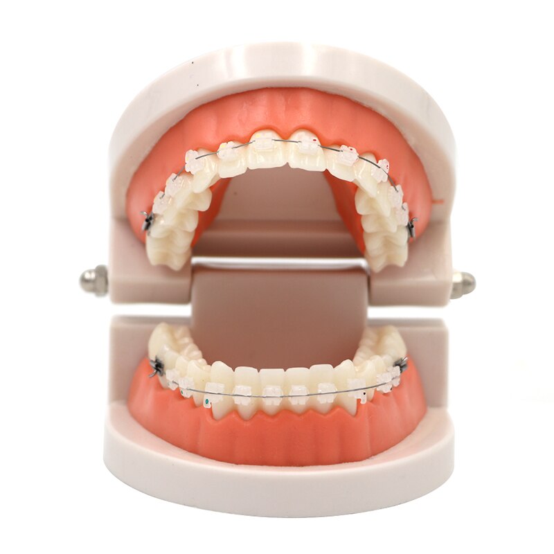 1pc 3 Sizes Dental Teeth Model Ceramic Bracket Met... – Vicedeal