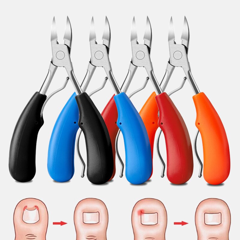 Toe Nail Clippers Remove Ingrown Toenail Cuticle S... – Grandado