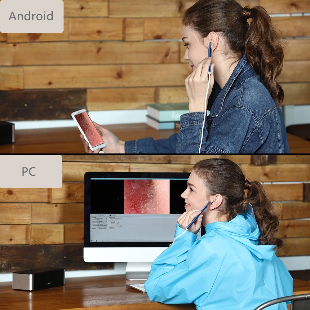 Ear Cleaning Endoscope USB Visual Ear Spoon 5.5mm ... – Vicedeal