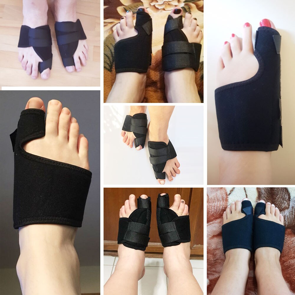 Bunion Corrector Splint Toe Straightener Support T... – Vicedeal