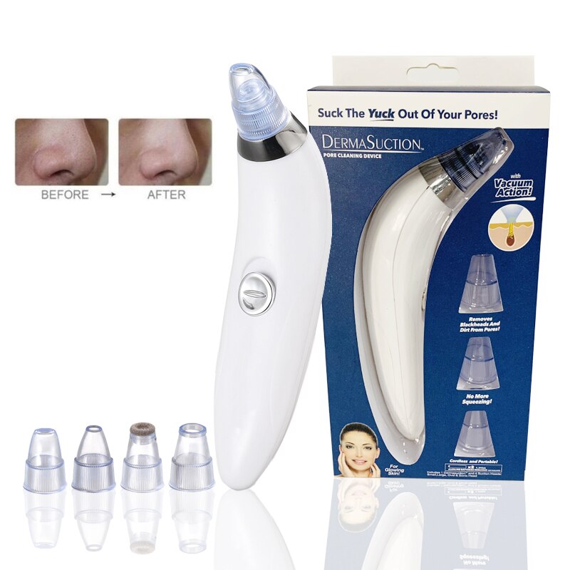 Blackhead Remover Facial Deep Cleansing Vacuum Acn... – Vicedeal