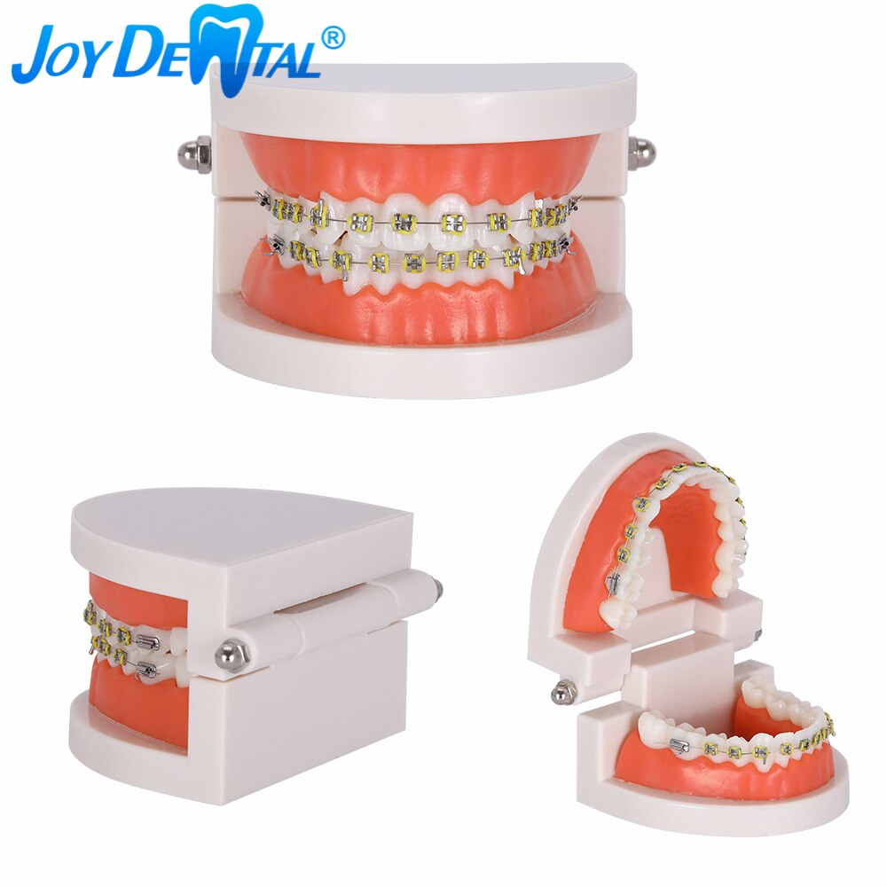 Dental Orthodontic Teeth Model with Metal Brackets... – Grandado