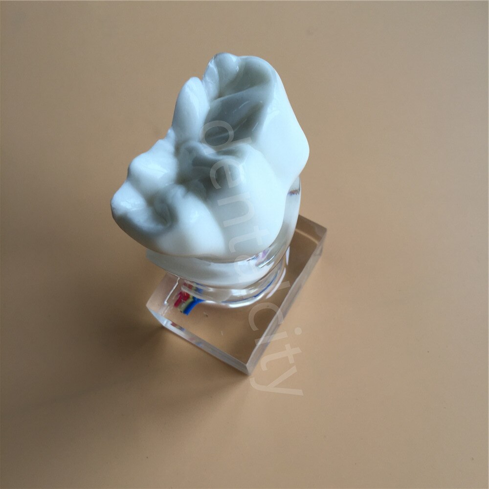 Dental Anatomical Molar Model molar inner structur... – Vicedeal