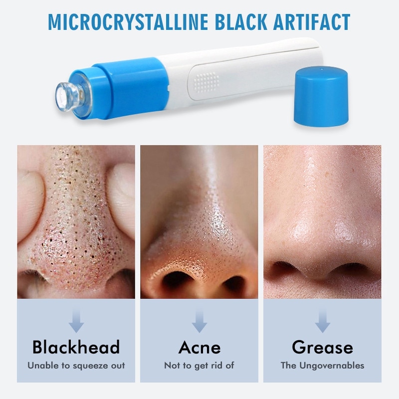 Black Head Machine Electric Facial Skin Care Pore ... – Grandado