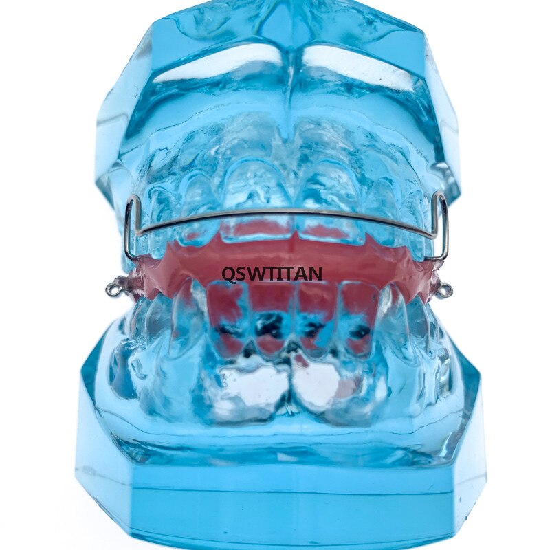 Teeth model orthodontic model with retainer for De... – Vicedeal