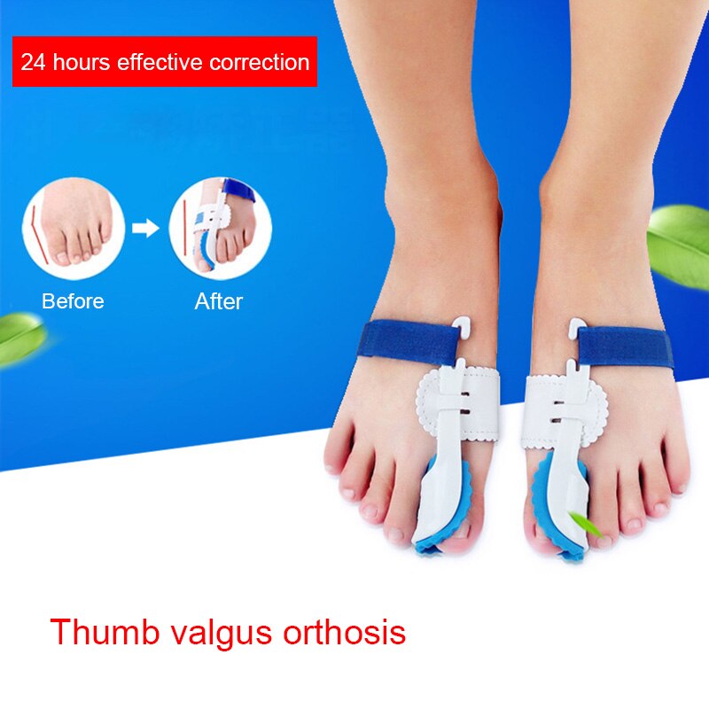 8pcs Bunion Corrector Relief Kit Cure Pain Bunion ... – Vicedeal