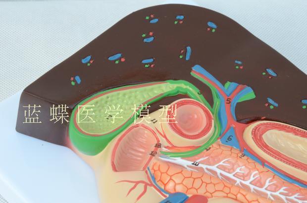 Hepatobiliary pancreaticoduodenal structuur model ... – Vicedeal