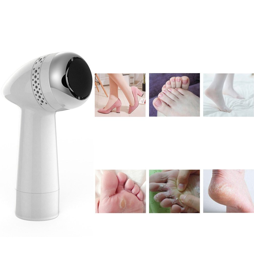 Electric Foot Files Vacuum Pedicure Tools Portable... – Vicedeal