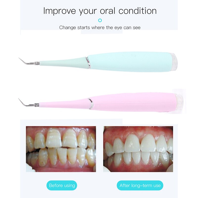 Teeth Whitening Oral Electric Ultrasonic Dental Sc... – Grandado