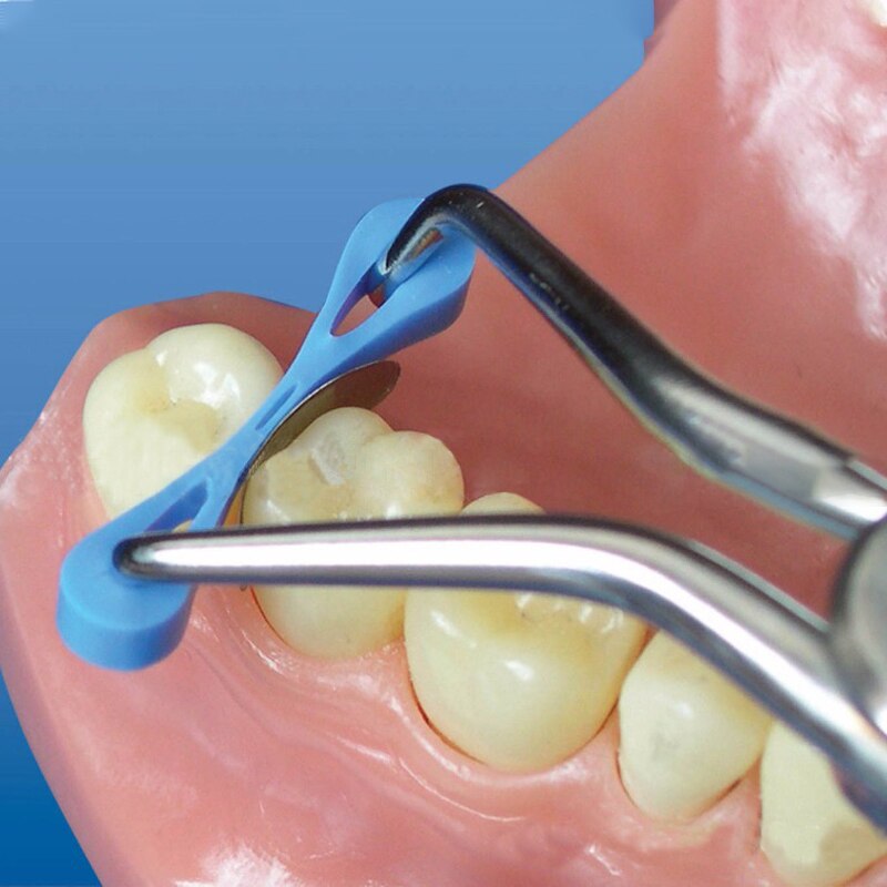 80Pcs/box Dental Elastic Rubber Fixing Wedges Auto... – Grandado