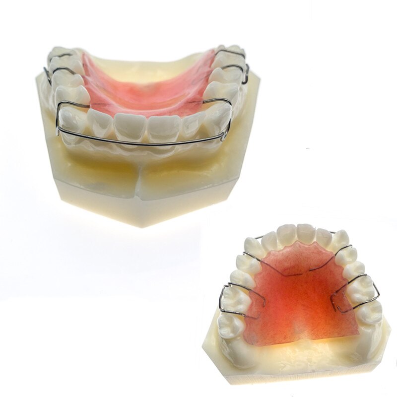 Teeth Model Upper jaw with retainer Demonstrates t... – Vicedeal