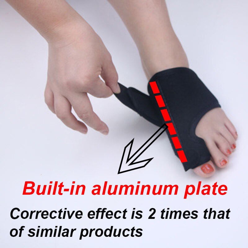 Hallux valgus hallux valgus hallux valgus knobbels... – Grandado