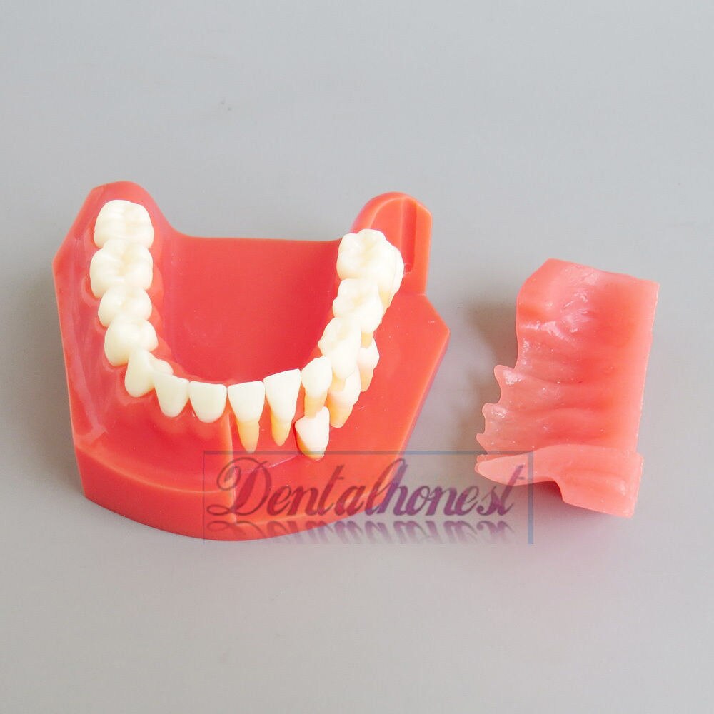 Dental Model #4006 01 - Teeth Eruption Development... – Vicedeal