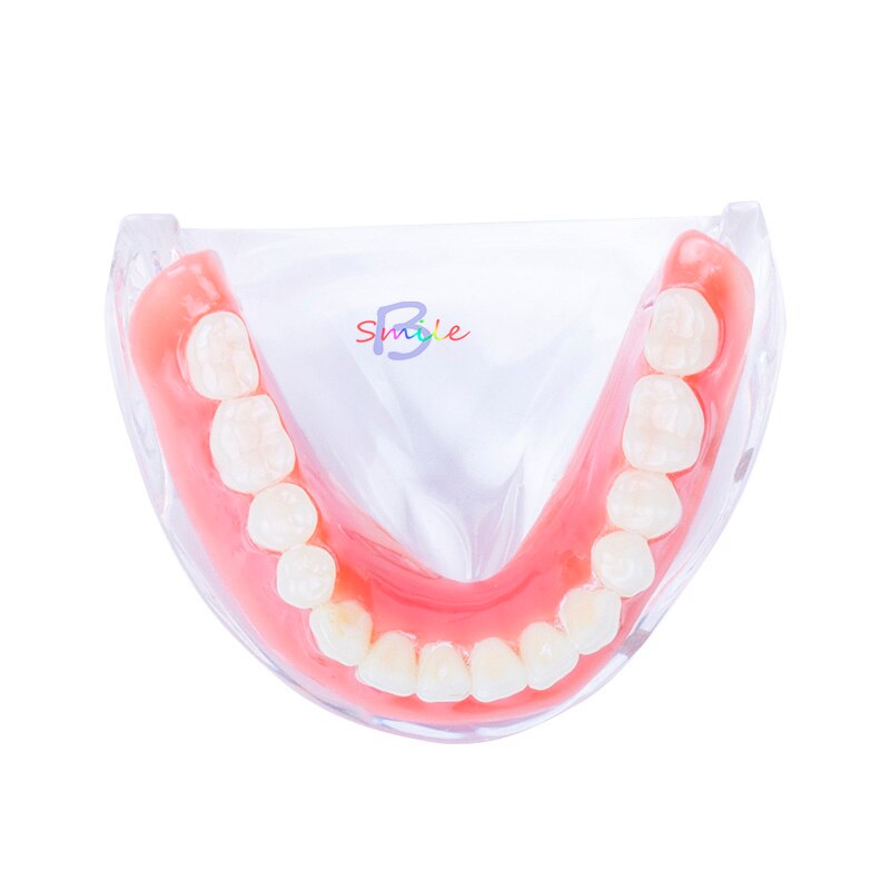 1pcs Dental Teaching Study Overdenture Teeth Model... – Vicedeal