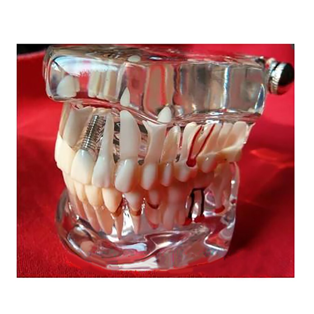 Dental display model dentist clinic stomatologist ... – Grandado