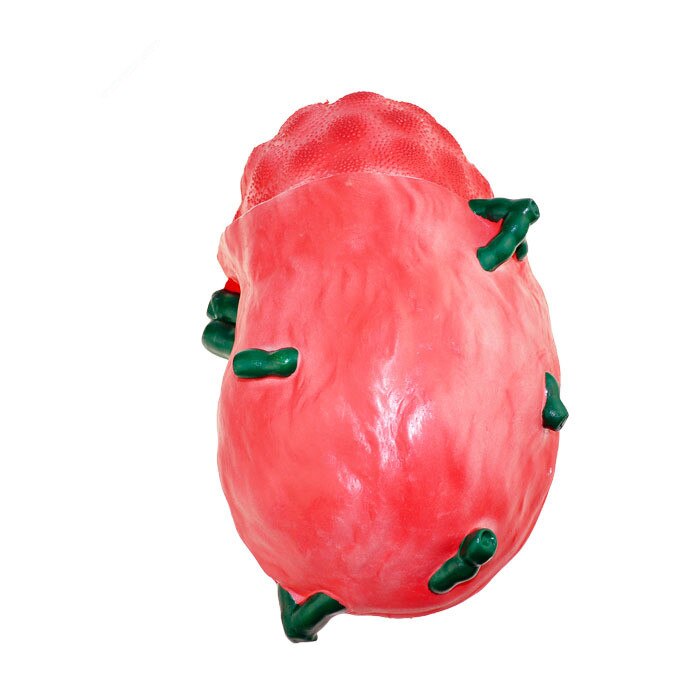 Lymphonodus Vergrootglas Model Menselijk Realistis... – LovingPrices