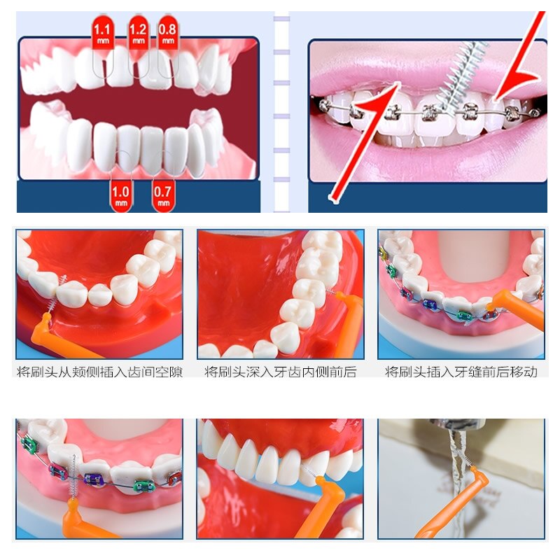 Rager Draad L-Type Rager Correctie Orthodontische ... – Grandado