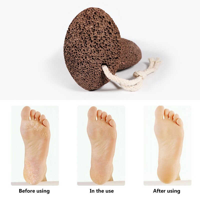 Hard Skin Callus Remover Scrub Pumice Tool Natural... – Vicedeal