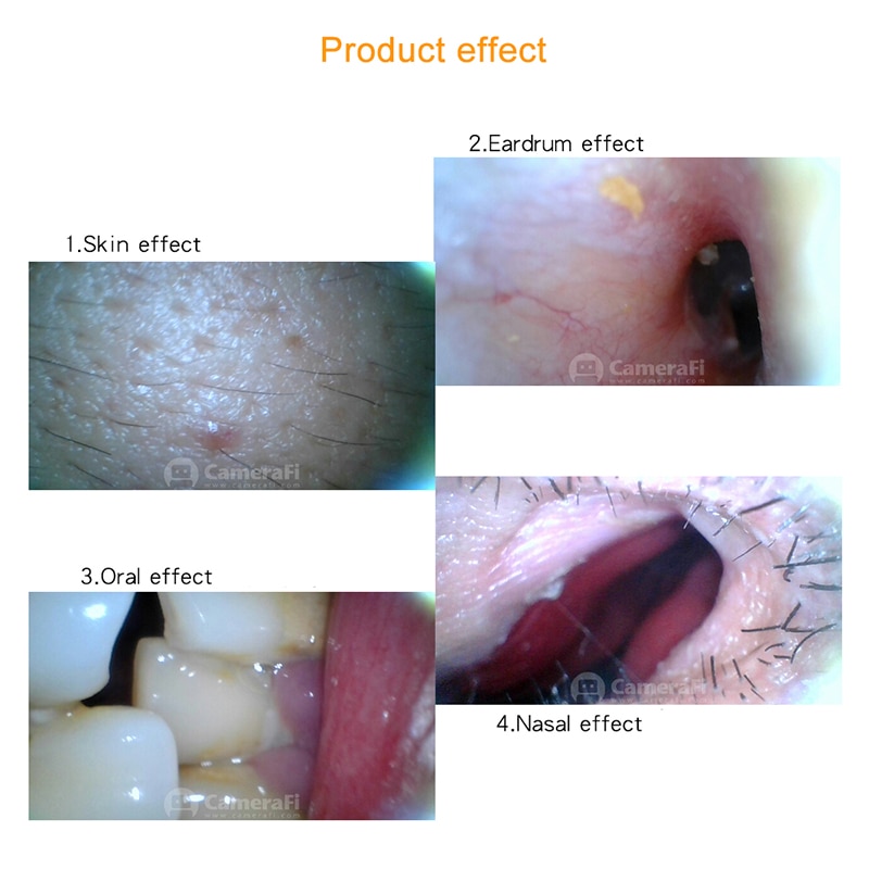 Micro USB Ear Cleaner Endoscope 2 in 1 Ear Pick Ca... – Grandado